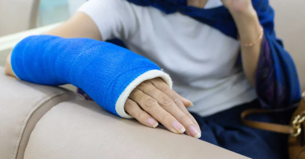 Ulnar Gutter Splint Cast Short Arm Splinting Technique: General Steps